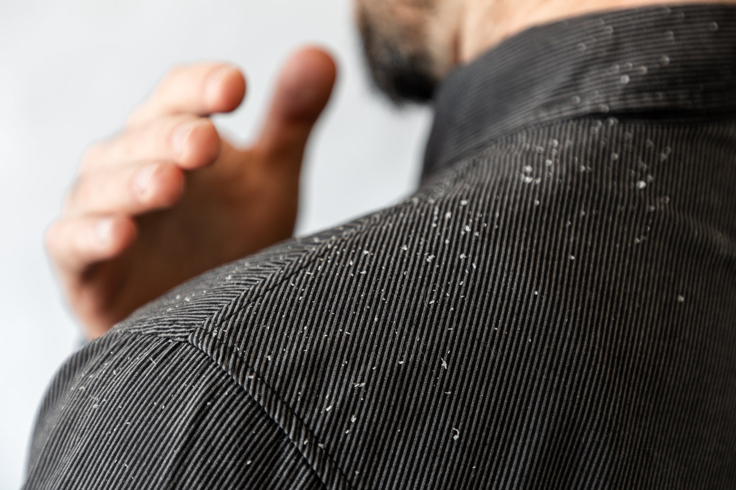 Banish Beard Dandruff | Ask the Skin Care Experts | Beauty Kin